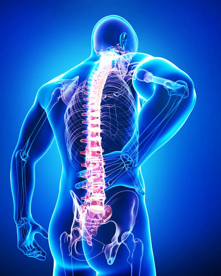 Які найкращі вправи для лікування болю в спині 42930_1
