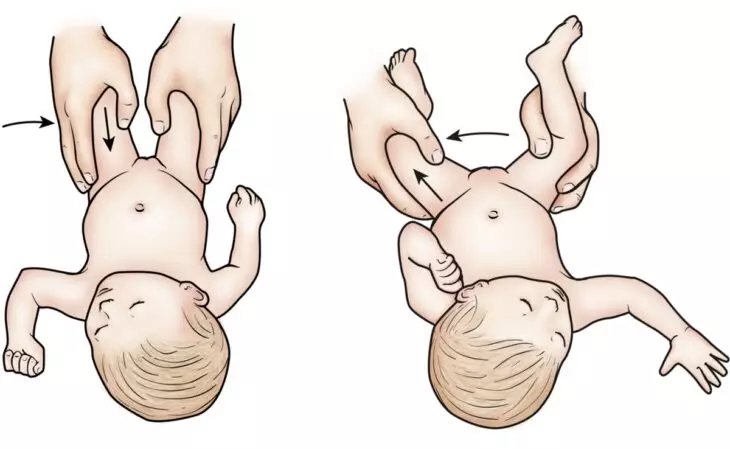 6 Mga Butang nga Hibal-an Bahin sa Developmental Hip Dysplasia sa mga Bata ug Gagmay nga mga Bata 506_1