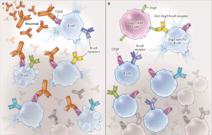 Ho una rara malattia autoimmune 54616_3