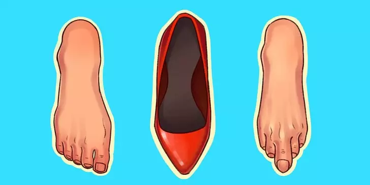 6 tipos de zapatos que pueden dañar tu cuerpo 58176_1