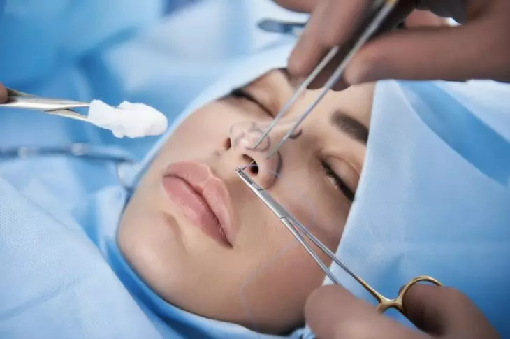 Rhinoplasty سے پہلے پوچھنے کے لیے 6 اہم سوالات 6042_5