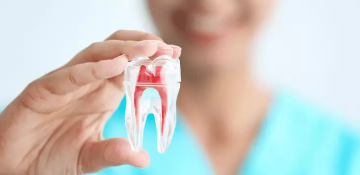 Os procedementos dentais máis comúns 6599_2